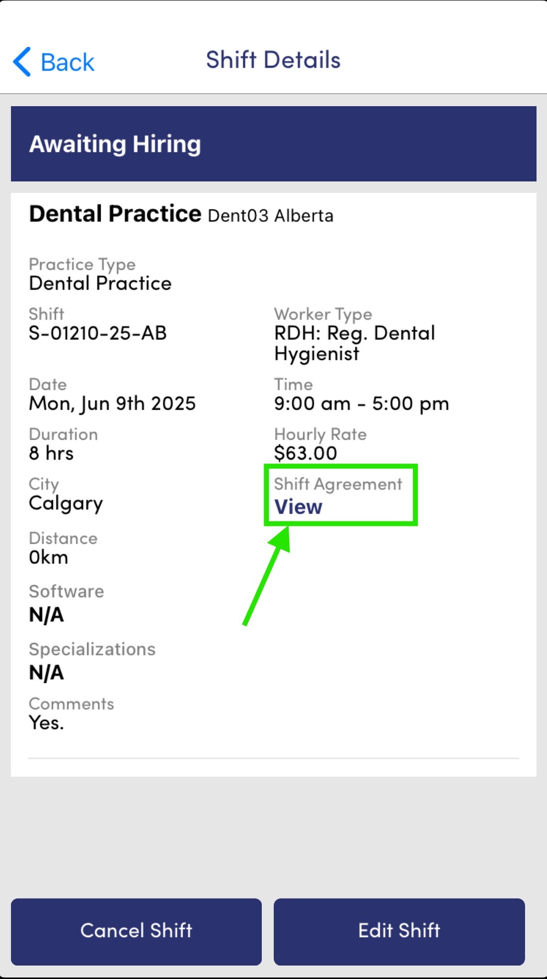 What is a Shift Agreement?