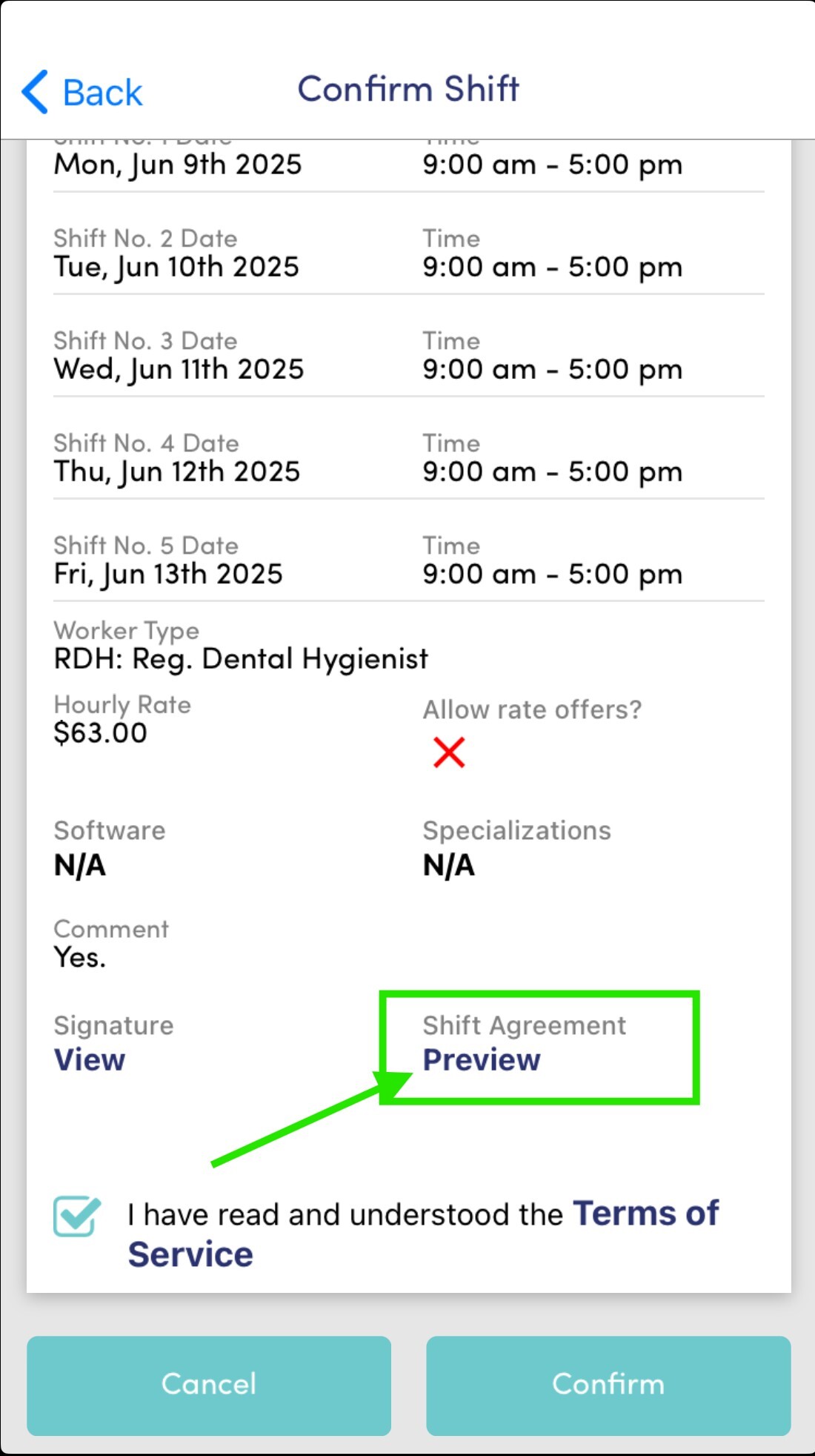 What is a Shift Agreement?